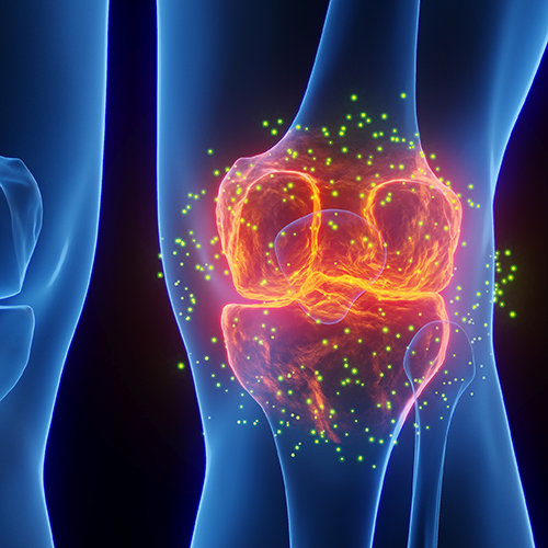 Exercise Regime Targets Rheumatoid Arthritis Pain Relief | Mirage News